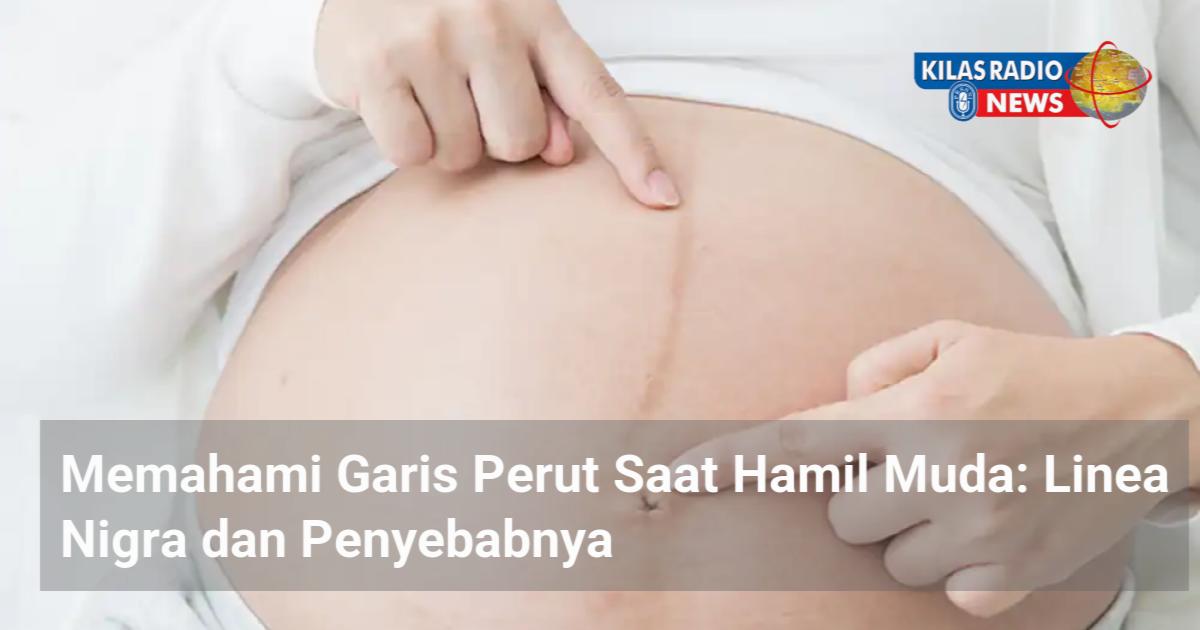 Memahami Garis Perut Saat Hamil Muda: Linea Nigra dan Penyebabnya